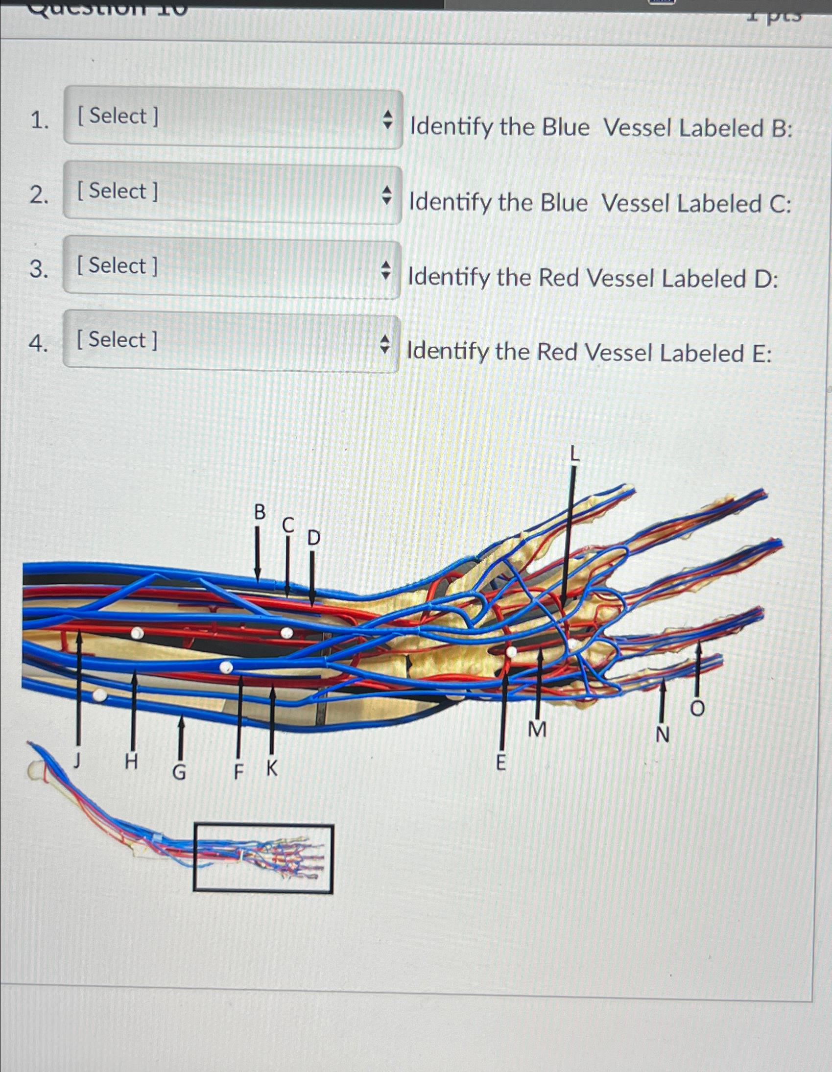 Solved Identify the Blue Vessel Labeled B:Identify the Blue | Chegg.com