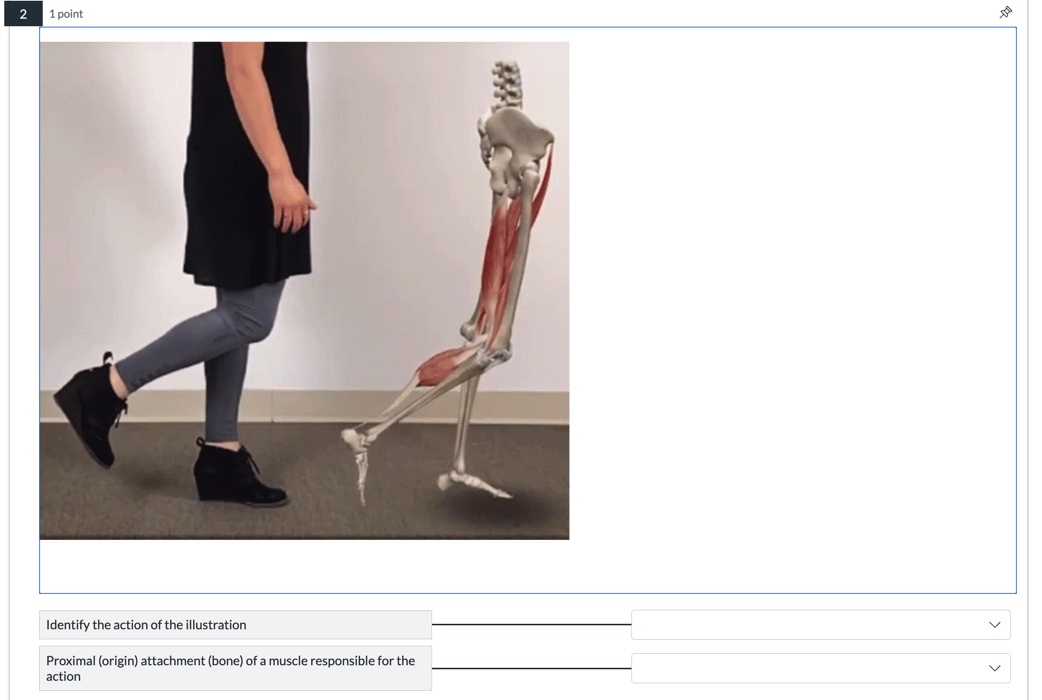 Solved Identify the action of the illustration. (Leg | Chegg.com