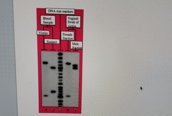 Solved DNA size markers Blood Vaginal Swab of Sample victim | Chegg.com