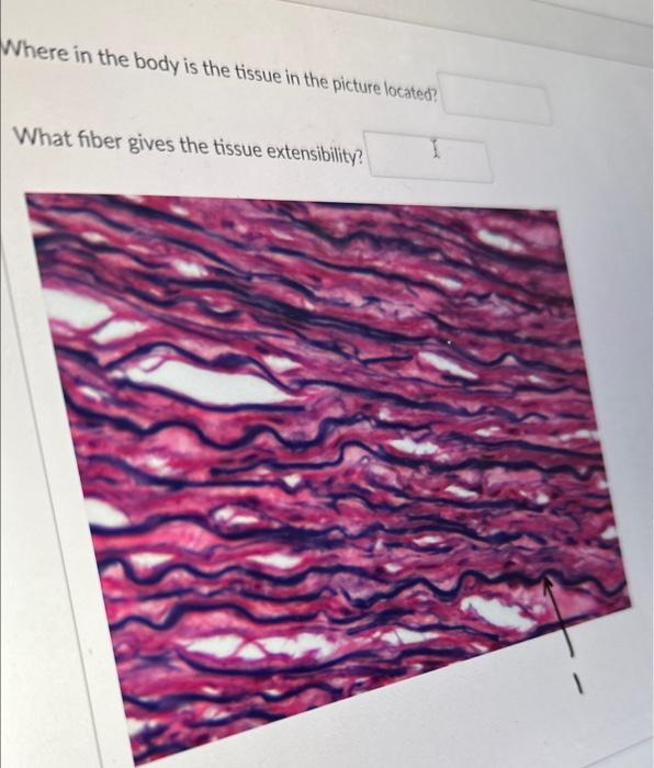 Solved Where in the body is the tissue in the picture | Chegg.com