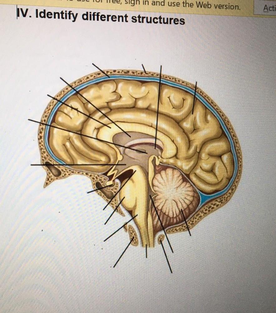 Solved Sigh in and use the Web version. IV. Identify | Chegg.com