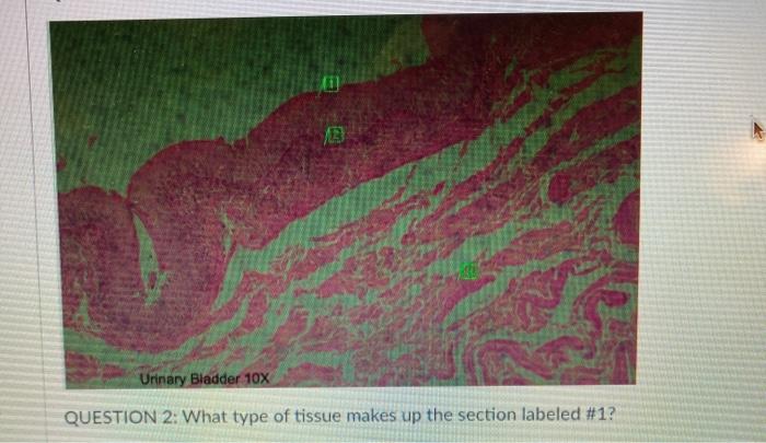 Solved Urinary Bladder 10x QUESTION 2: What type of tissue | Chegg.com