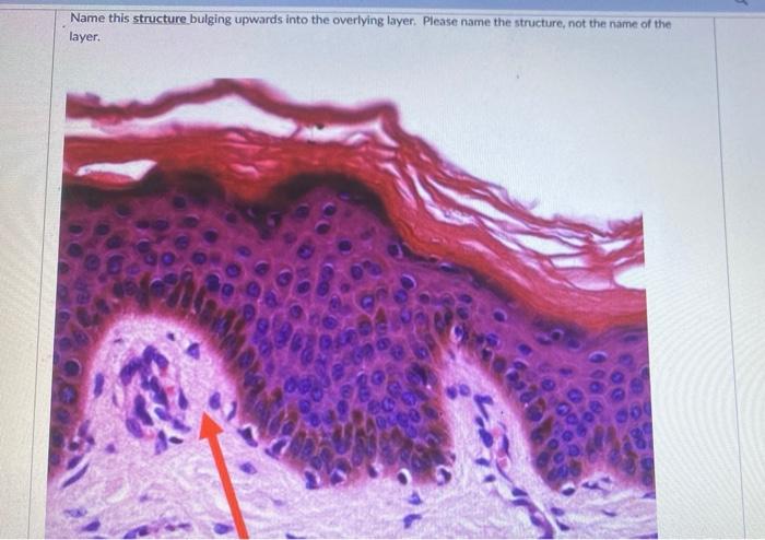 Solved Name this structure bulging upwards into the | Chegg.com
