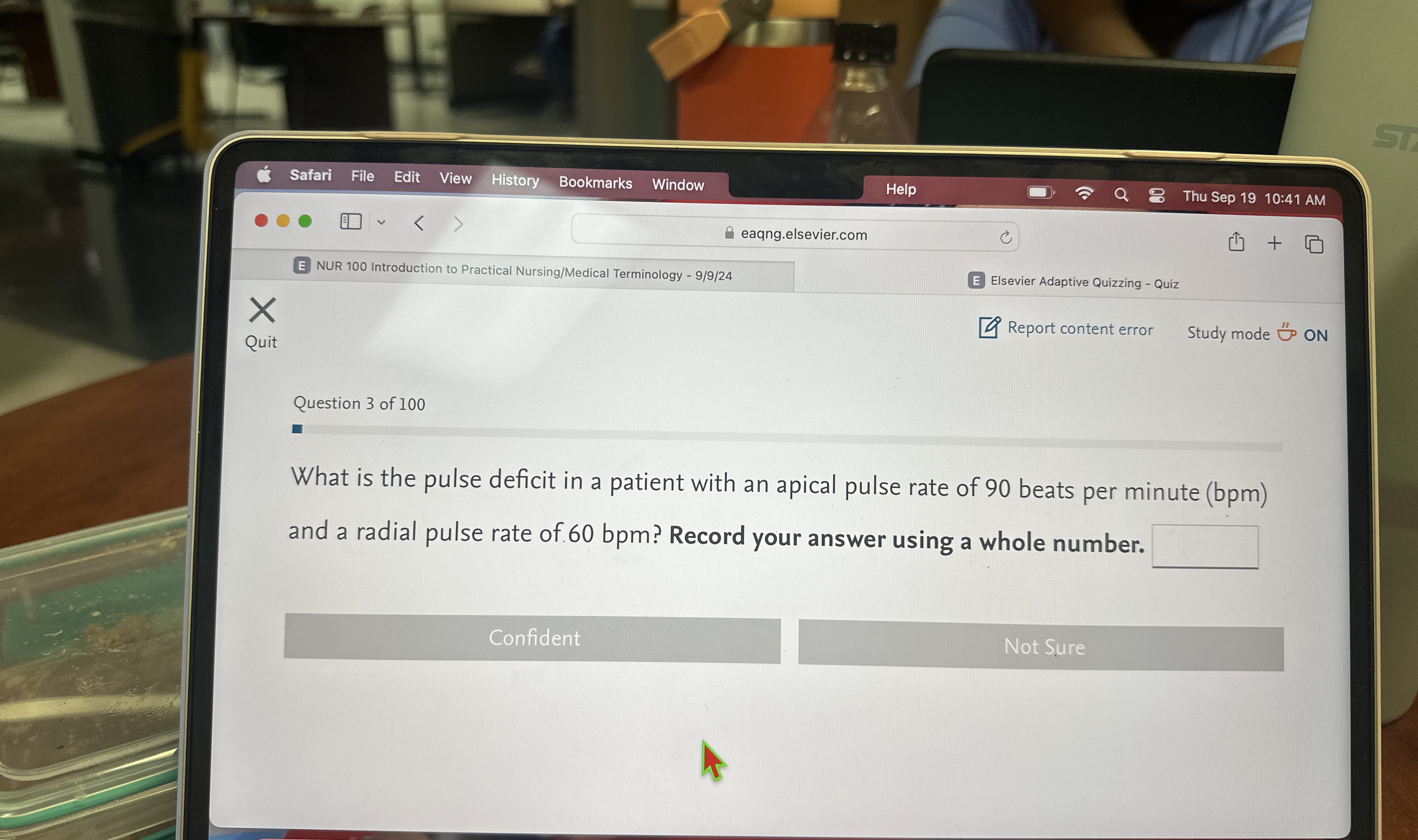 Solved What is the pulse deficit in a patient with an apical | Chegg.com