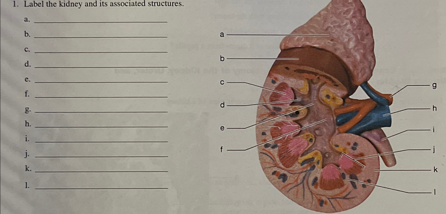 Solved Label the kidney and its associated | Chegg.com