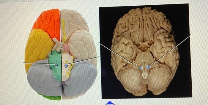Solved Which structure is highlighted at the leader line. | Chegg.com