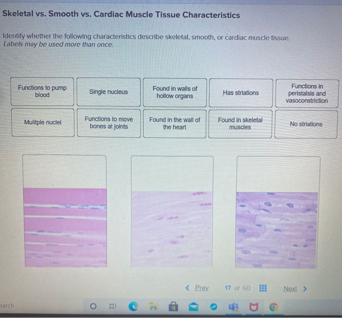 Solved Skeletal Vs Smooth Vs Cardiac Muscle Tissue Chegg