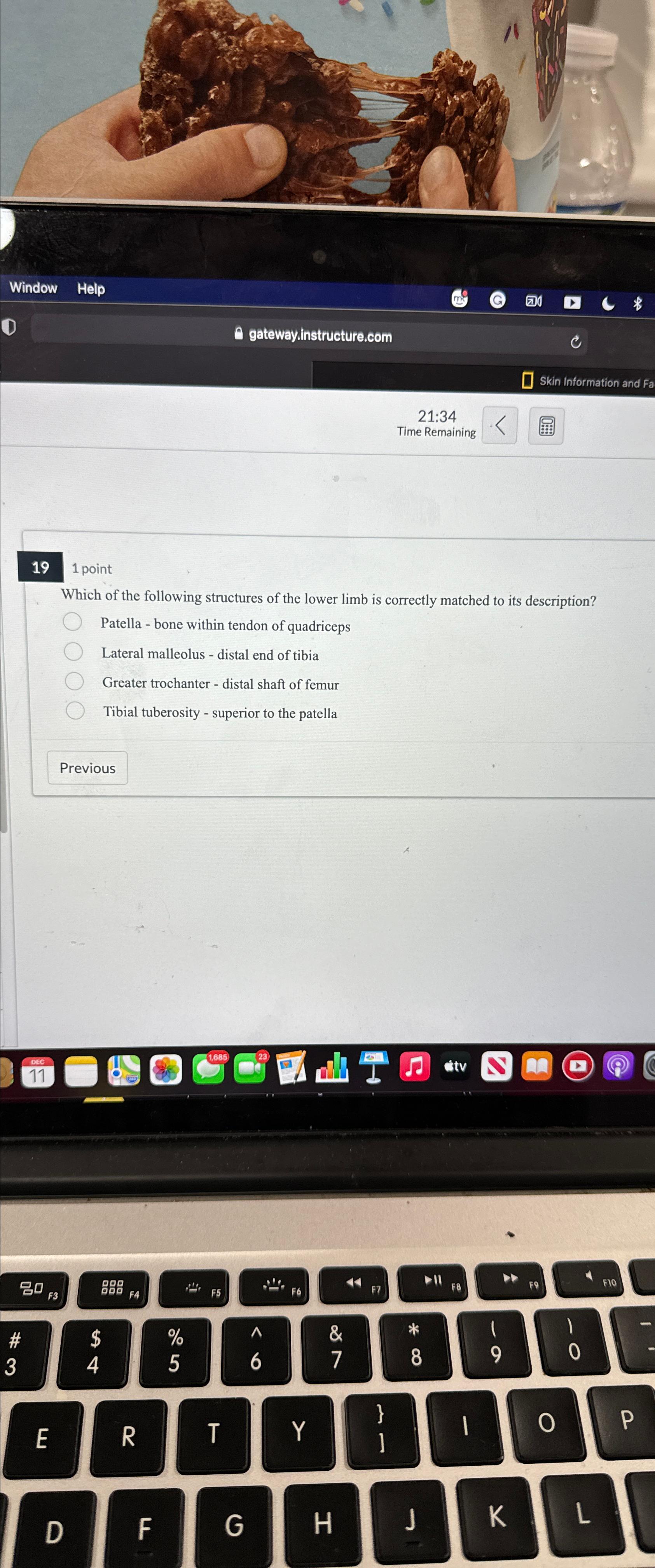 Solved 1 ﻿pointWhich of the following structures of the | Chegg.com