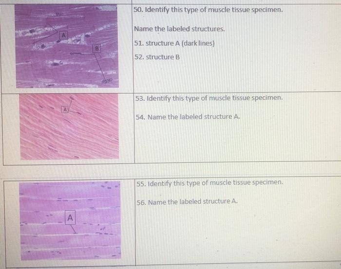 Solved 50. Identify this type of muscle tissue specimen. | Chegg.com