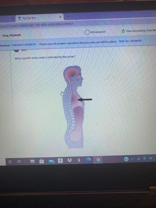 Solved x Top Hat Test text/27224023788167980-7310-480b-b389 | Chegg.com