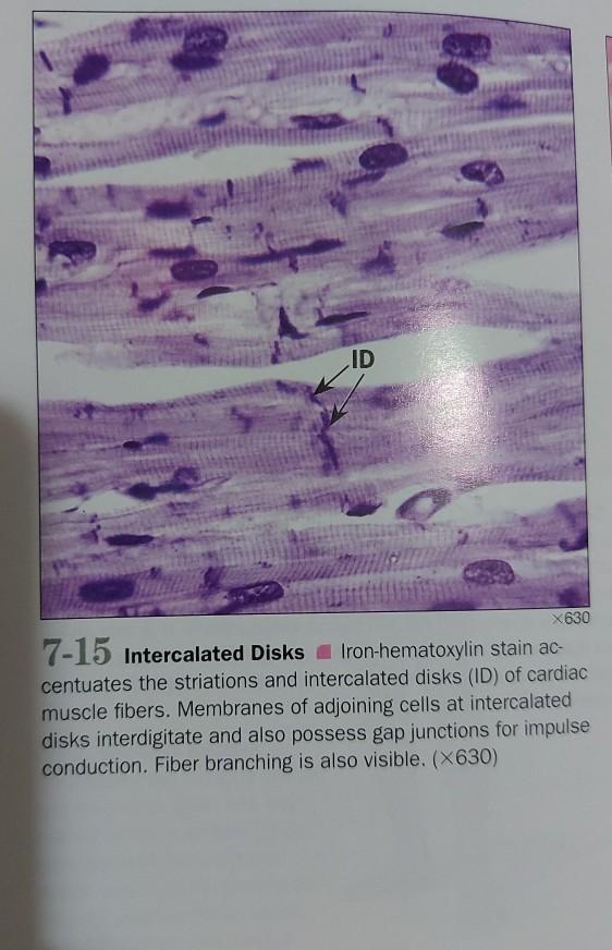 Solved ID X630 7-15 Intercalated Disks Iron-hematoxylin | Chegg.com