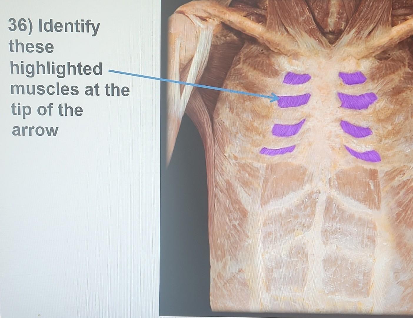 Solved 36) Identify these highlighted muscles at the tip of | Chegg.com