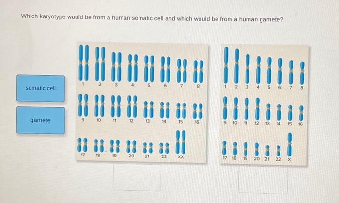 Solved Which karyotype would be from a human somatic cell | Chegg.com