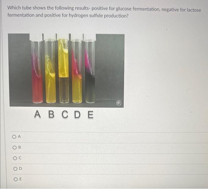 Solved Which tube shows the following results- positive for | Chegg.com