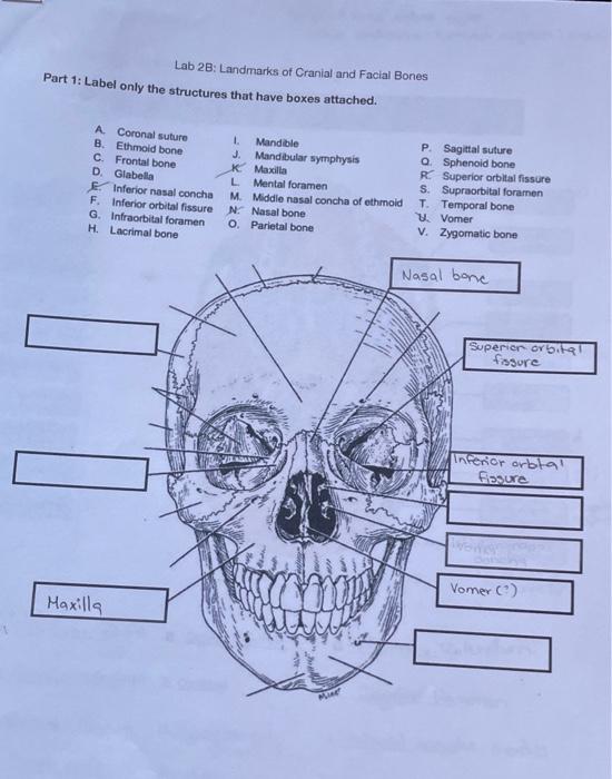 Solved Lab 28: Landmarks of Cranial and Facial Bones Part 1: | Chegg.com