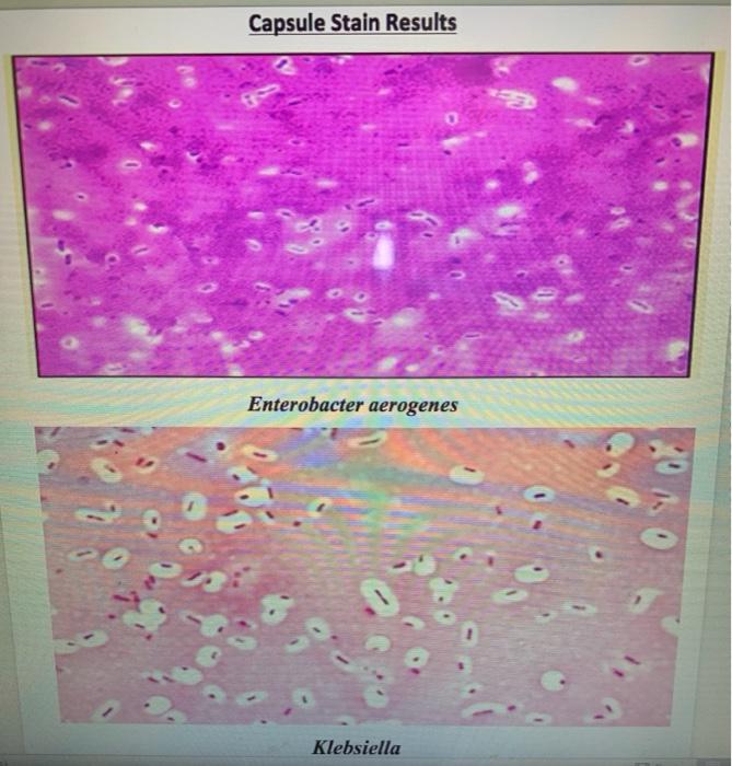 Solved Acid-Fast Stains OBSERVATIONS AND INTERPRETATIONS 1 | Chegg.com