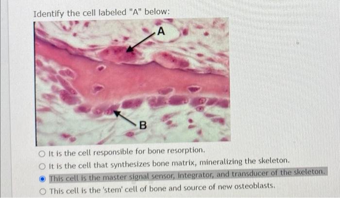 Solved Identify the cell labeled "A" below: A B It is the | Chegg.com