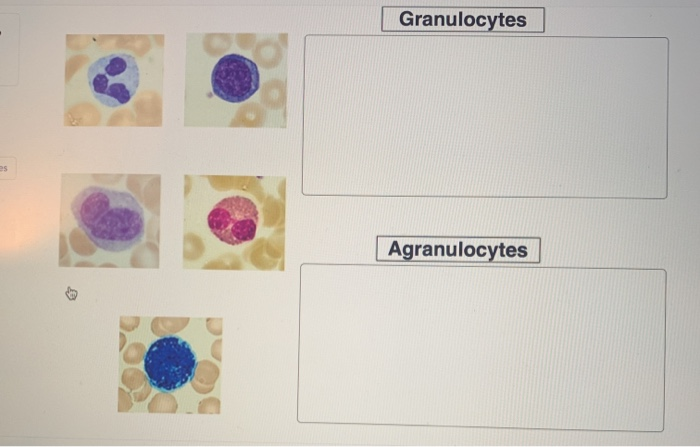 Solved Granulocytes Agranulocytes | Chegg.com