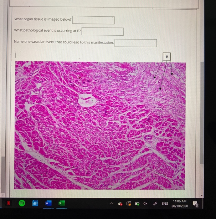 Solved What organ tissue is imaged below? What pathological | Chegg.com