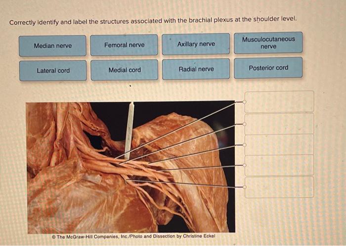 Solved Correctly identify and label the structures | Chegg.com