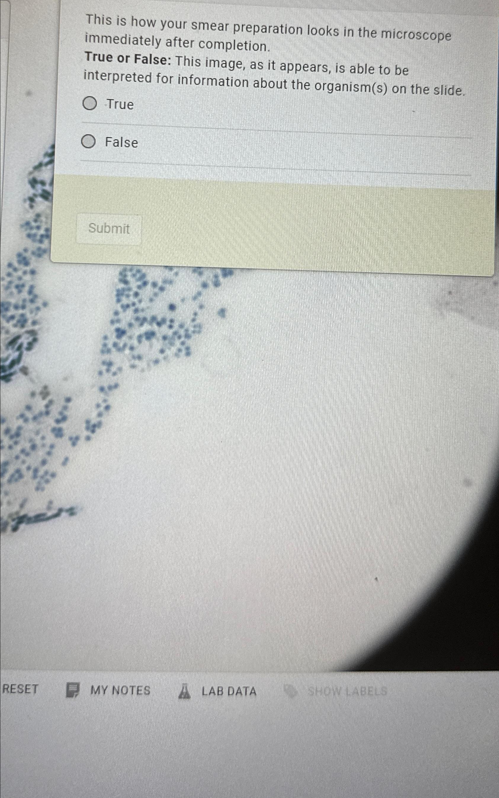 Solved This is how your smear preparation looks in the | Chegg.com