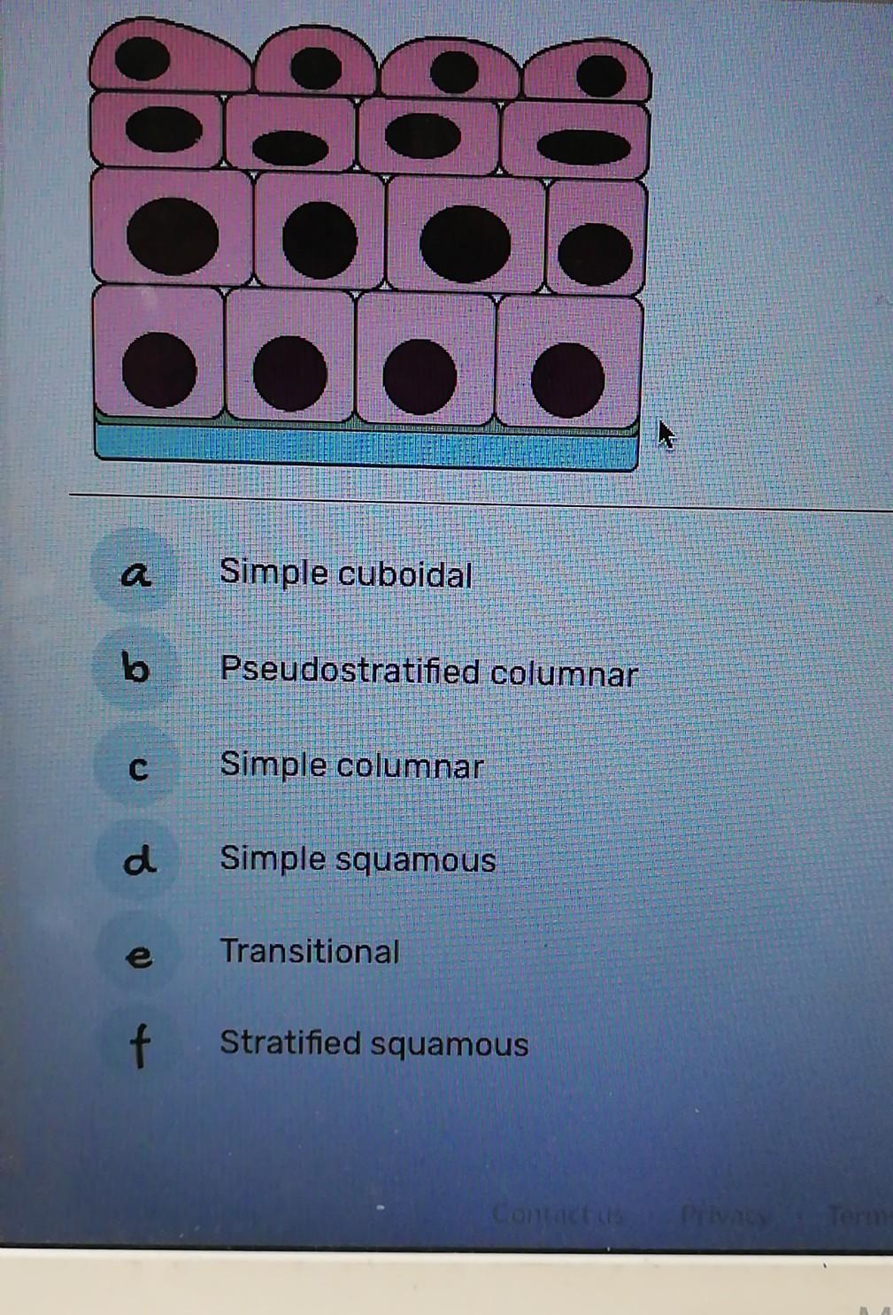 Solved Simple cuboidal b Pseudostratified columnar с Simple | Chegg.com