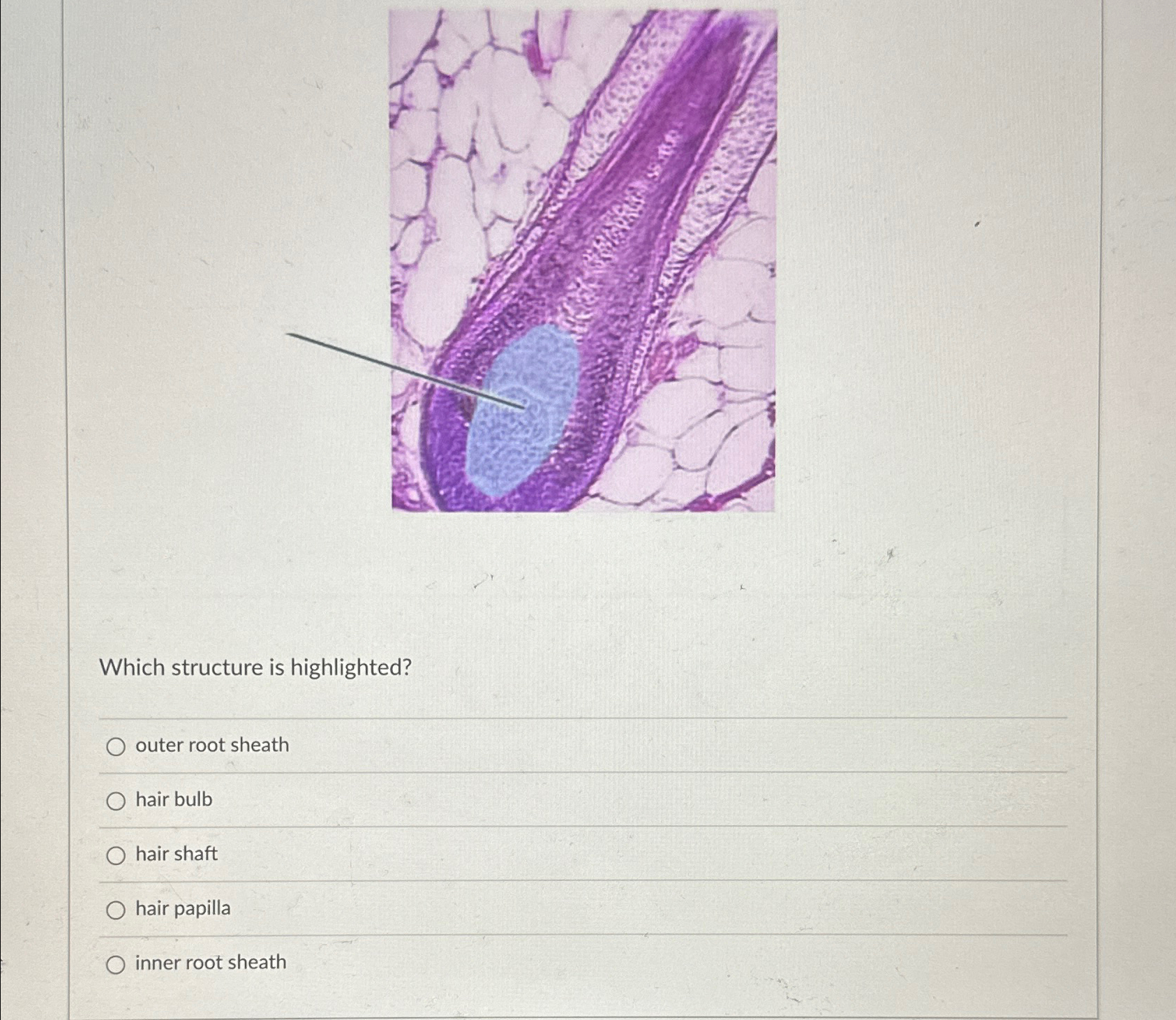 Solved Which structure is highlighted?outer root sheathhair | Chegg.com
