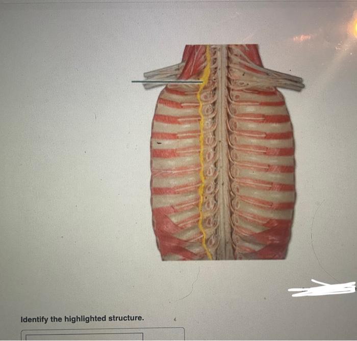 Solved Identify the highlighted structure. | Chegg.com