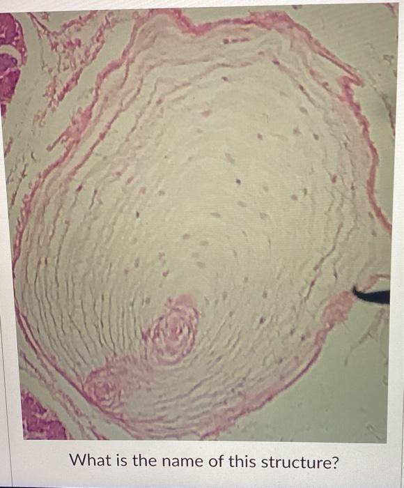 Solved What is the name of this structure? | Chegg.com