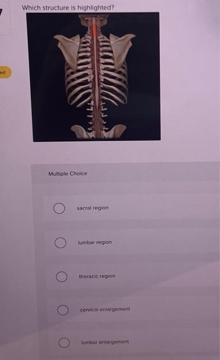 Solved Which structure is highlighted? Multiple Choice | Chegg.com