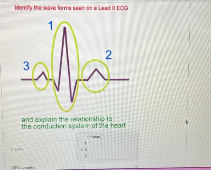 Solved Identify the wave forms seen on a Lead II ECG 1 2 3 | Chegg.com