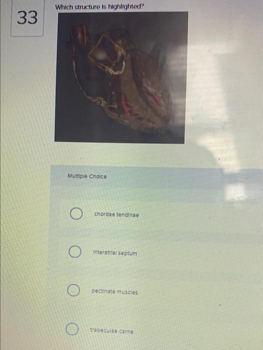 Solved Which structure is highlighted? 33 Multiple Choice | Chegg.com