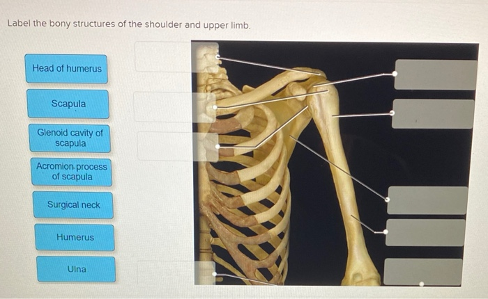 Solved Label the bony structures of the shoulder and upper | Chegg.com