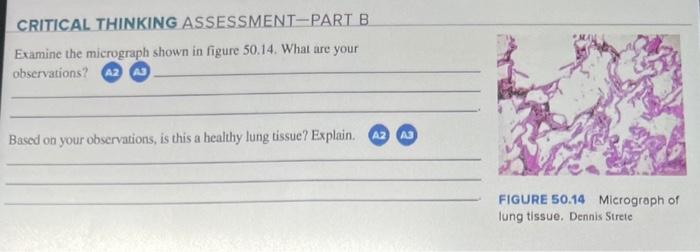 Solved Based On Your Observations Is This A Healthy Lung