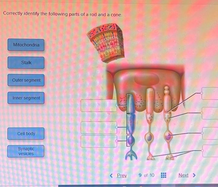 Solved Correctly identify the following parts of a rod and a | Chegg.com