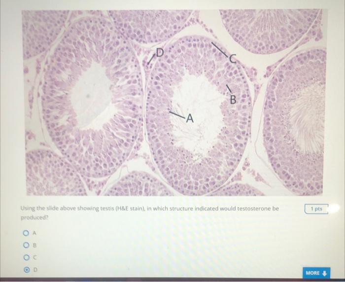 Solved Using the slide above showing testis (H\&E stain), in | Chegg.com
