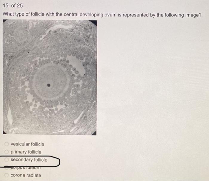 Solved What type of follicle with the central developing | Chegg.com