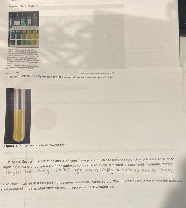 Solved Snyder interpretation: TE YUN AM La 7 W Morgan Please | Chegg.com