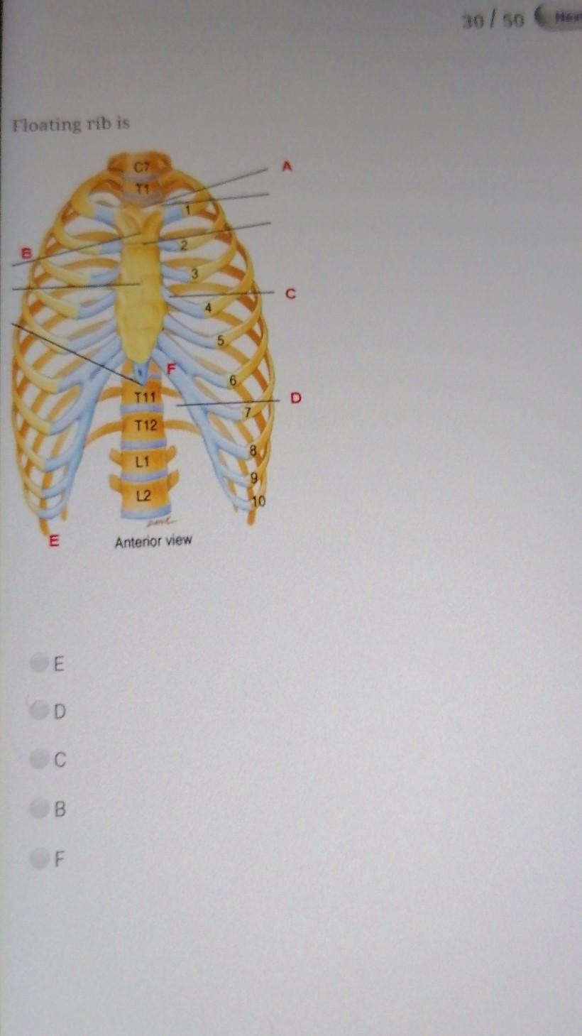 Solved 3o/ so har Floating rib is C7 С TAAVAD T11 T12 8 L1 9 | Chegg.com