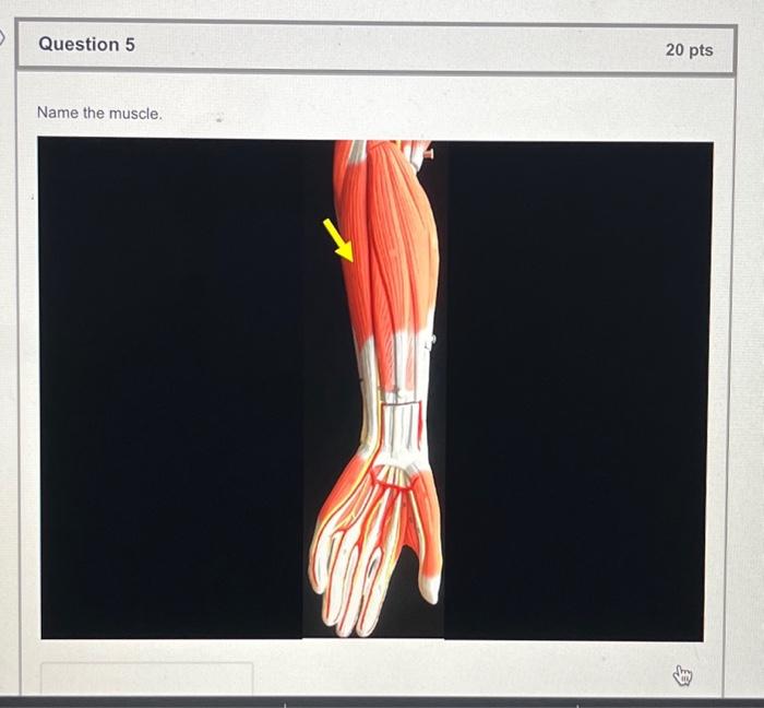 Solved Name the muscle. | Chegg.com