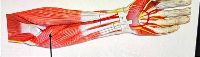 Solved A) What is the muscle the arrow is pointing to?B) | Chegg.com