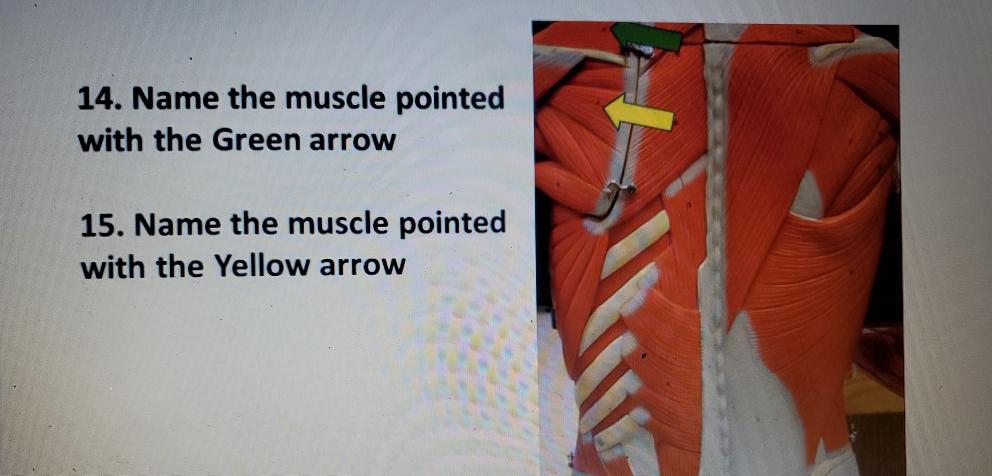 Solved 14. Name the muscle pointed with the Green arrow 15. | Chegg.com