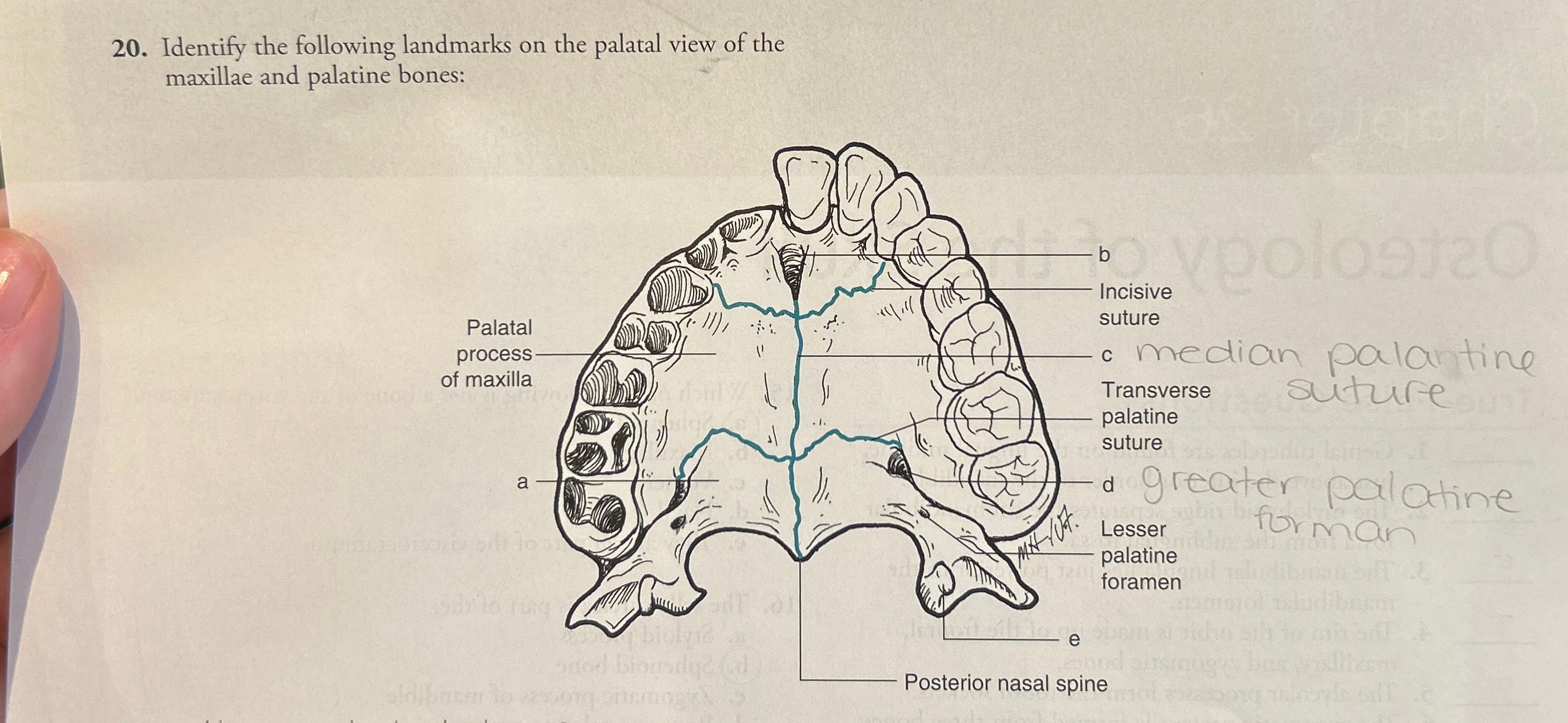 Solved Identify the following landmarks on the palatal view | Chegg.com