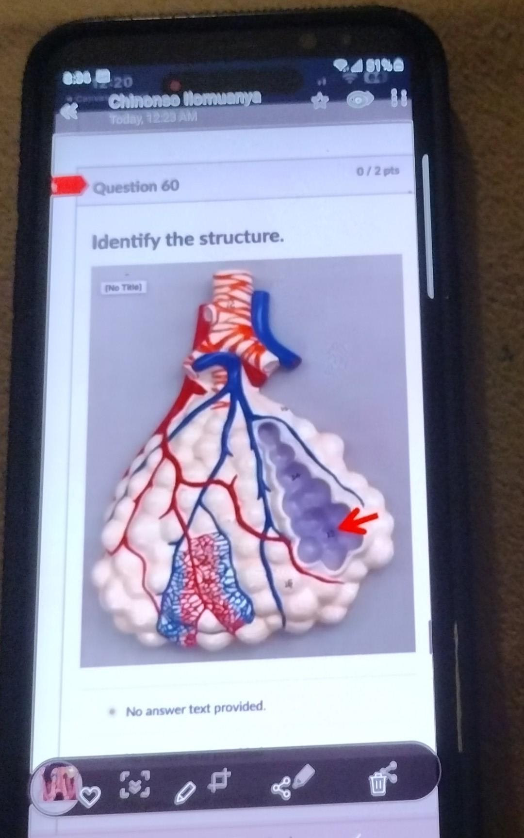 Name the anatomical feature. Ventral root Ventral | Chegg.com