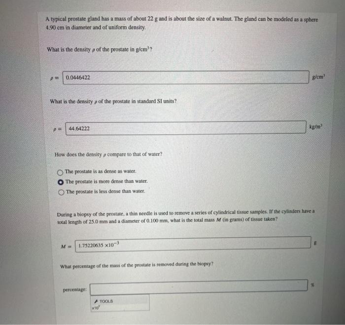 Solved A typical prostate gland has a mass of about 22 g and | Chegg.com