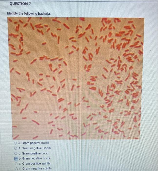 Solved Identify the following bacteria: A. Gram positive | Chegg.com