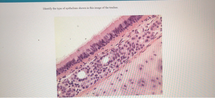 Solved Identify the structure highlighted in the image. Be | Chegg.com