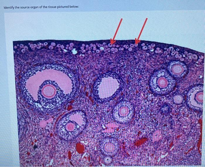 Solved Identify the source organ of the tissue pictured | Chegg.com
