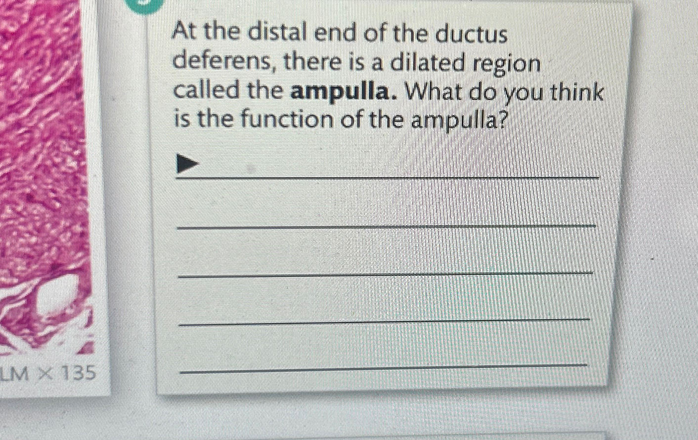 Solved At the distal end of the ductus deferens, there is a | Chegg.com