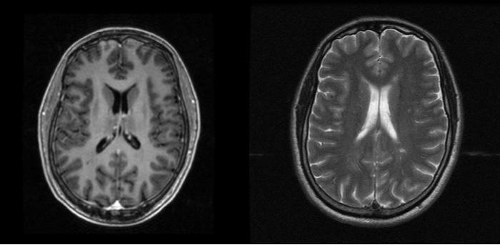Solved What are the 3 key magnetic fields in the MRI | Chegg.com